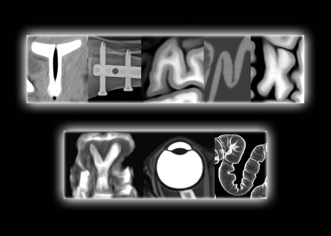 Xray Artistry | Xray Art